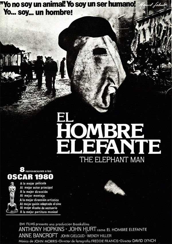 El hombre elefante - Película 1980 - SensaCine.com.mx